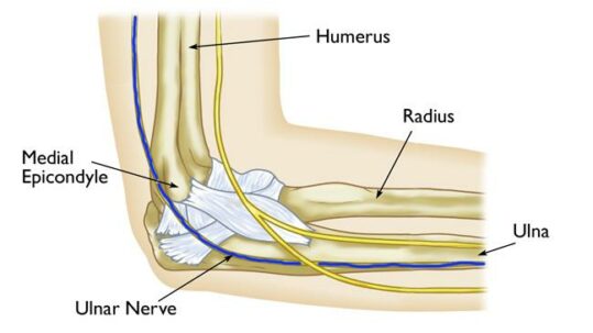 Inklemming van de nervus ulnaris | Orthopedie & Traumatologie Mortsel